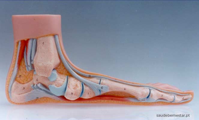 Pé Plano ou Pé Chato - o que é, causas, sintomas, tratamento